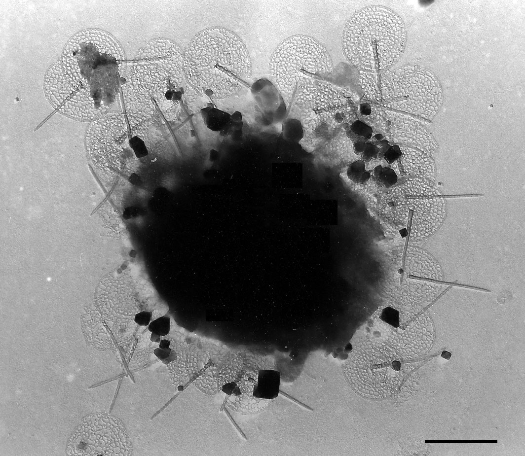 Paraphysomonas foraminifea