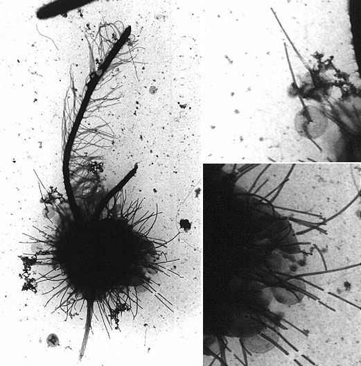 Paraphysomonas vestita